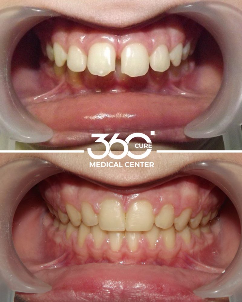 Top Dental & Skincare Center in Abu Dhabi | 360 Cure Clinic