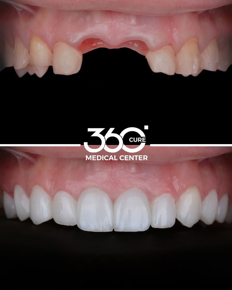 Top Dental & Skincare Center in Abu Dhabi | 360 Cure Clinic