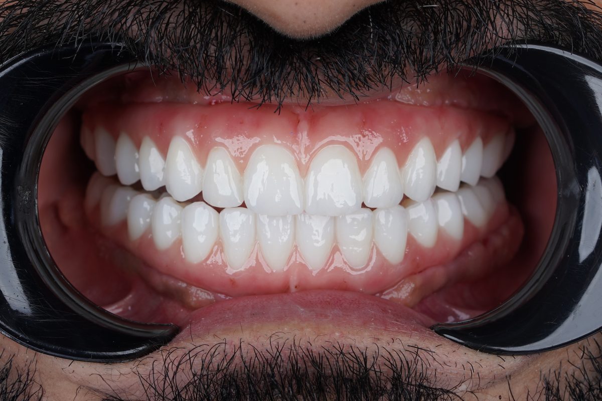 Top Dental & Skincare Center in Abu Dhabi | 360 Cure Clinic