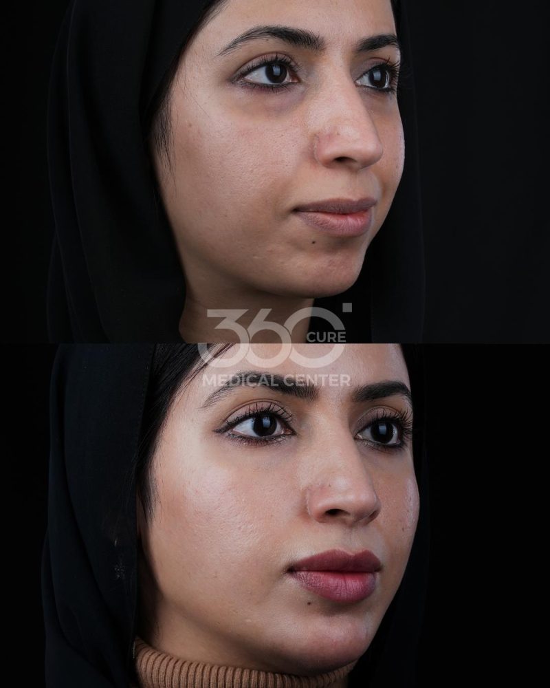 Top Dental & Skincare Center in Abu Dhabi | 360 Cure Clinic